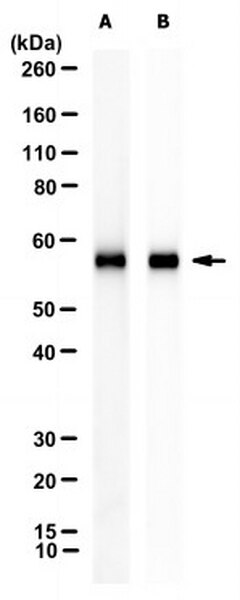 Anti-Tau Antibody, clone 10C5 | MABN2402-25UG